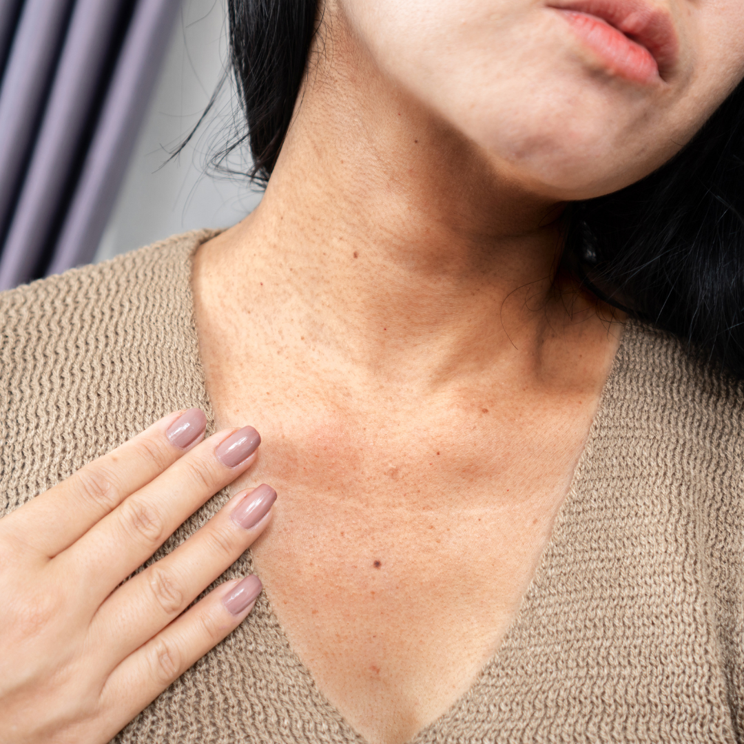 How To Lighten Dark Neck Naturally – Veenourish